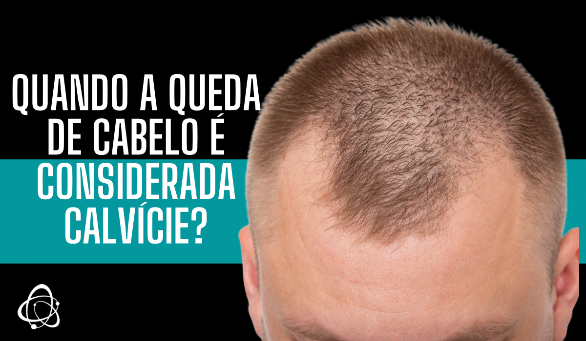 Quando a queda de cabelo pode ser calvície? - Spazio Lins