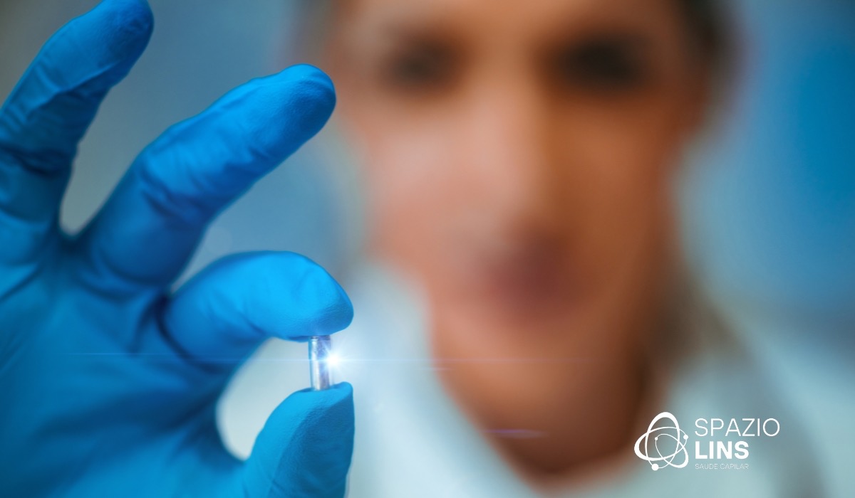 Eficácia do Chip Capilar no Tratamento da Calvície - Spazio Lins